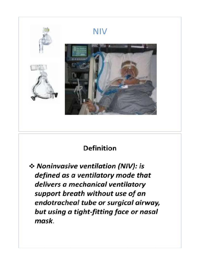 Non Invasive Mechanical Ventilation | PDF