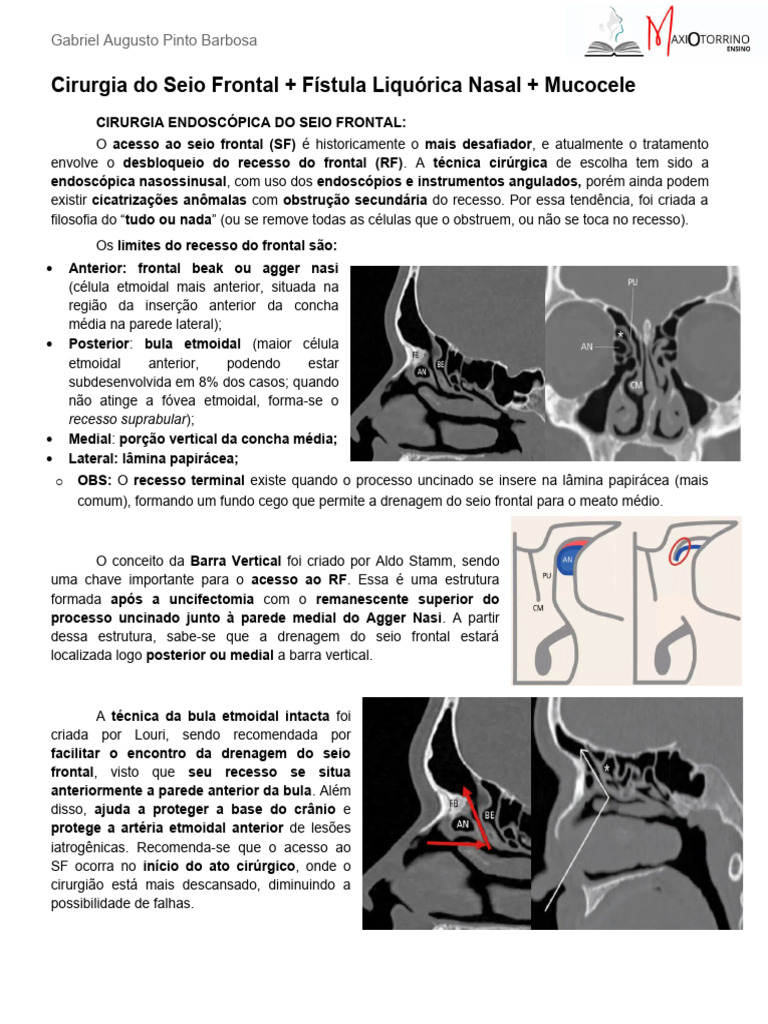 Cirurgia Frontal e Fístula Liquórica Nasal | PDF | Líquido ...