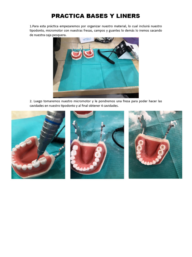 Bases y Liners Practica | PDF