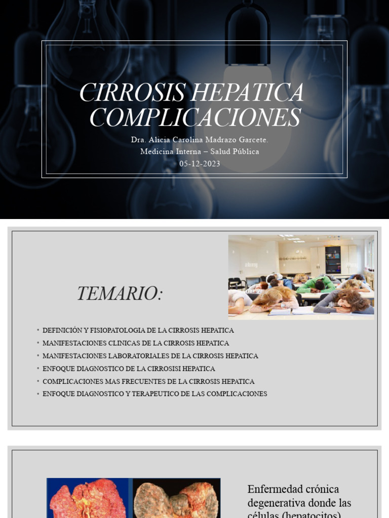 Cirrosis Hepatica y Sus Complicaciones 2023 | Descargar gratis PDF | Cirrosis | Enfermedades y ...