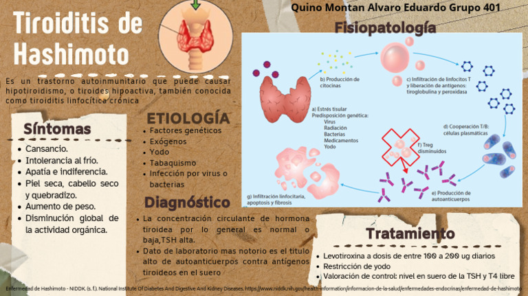 Tiroiditis de Hashimoto: Síntomas y Diagnóstico | PDF | Tiroides ...