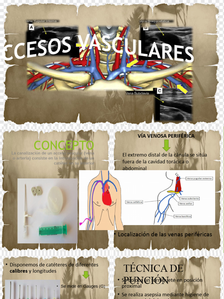 Accesos Venosos 1 | PDF | Terapia intravenosa | Sistema cardiovascular
