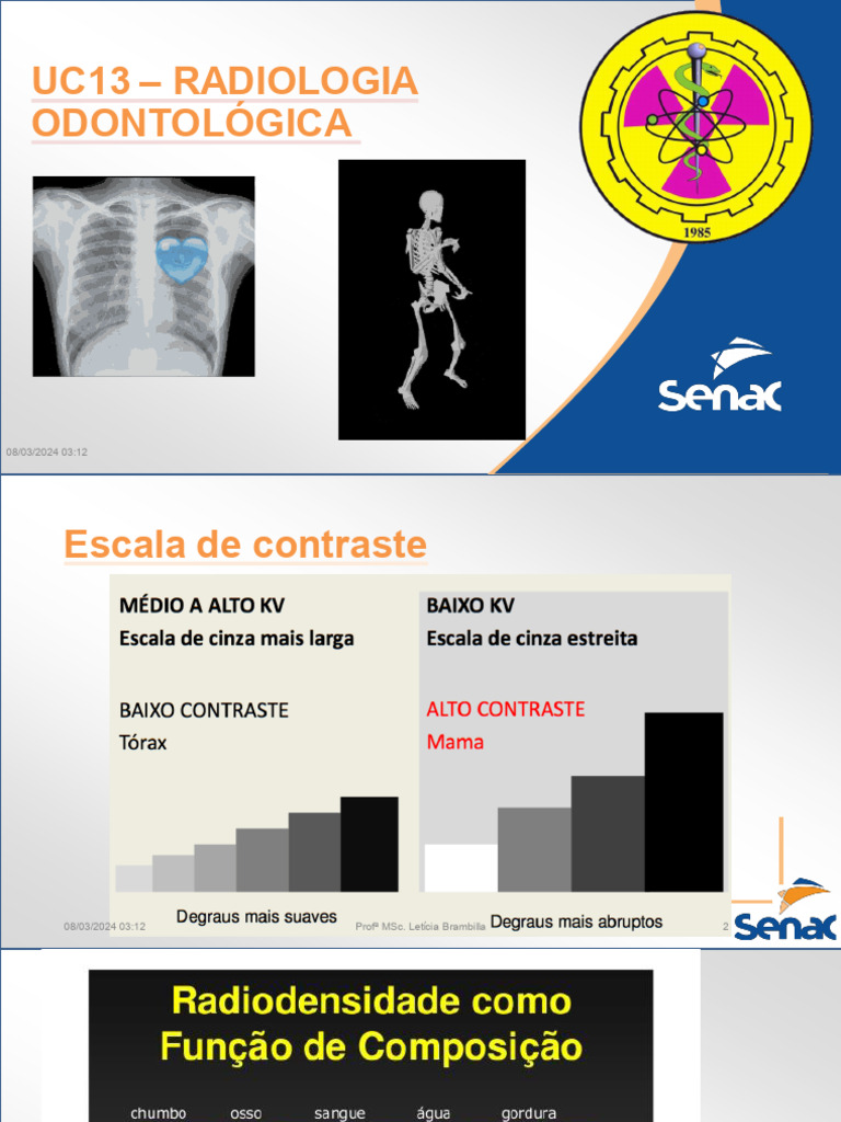 Aula 2 UC13 | PDF | Dentina | Dente