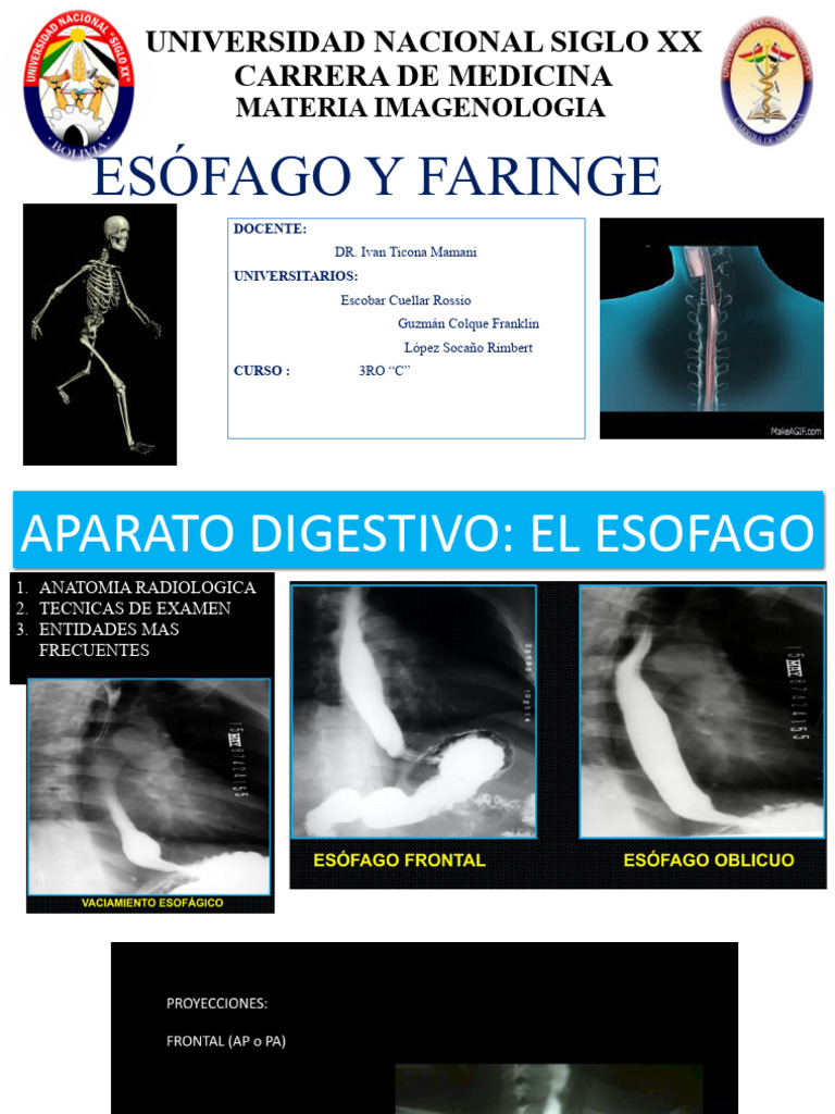 Esofago y Faringe | PDF | Esófago | Cáncer