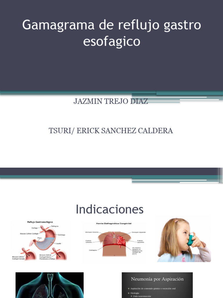 Gammagrama de Reflujo Gastroesofágico | PDF