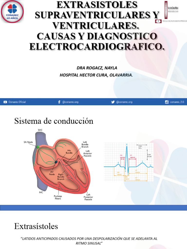Extrasistoles | PDF | Electrocardiografia | Especialidades Medicas