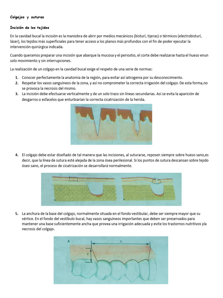 Colgajos y Suturas Final | PDF | Sutura Quirúrgica | Hueso