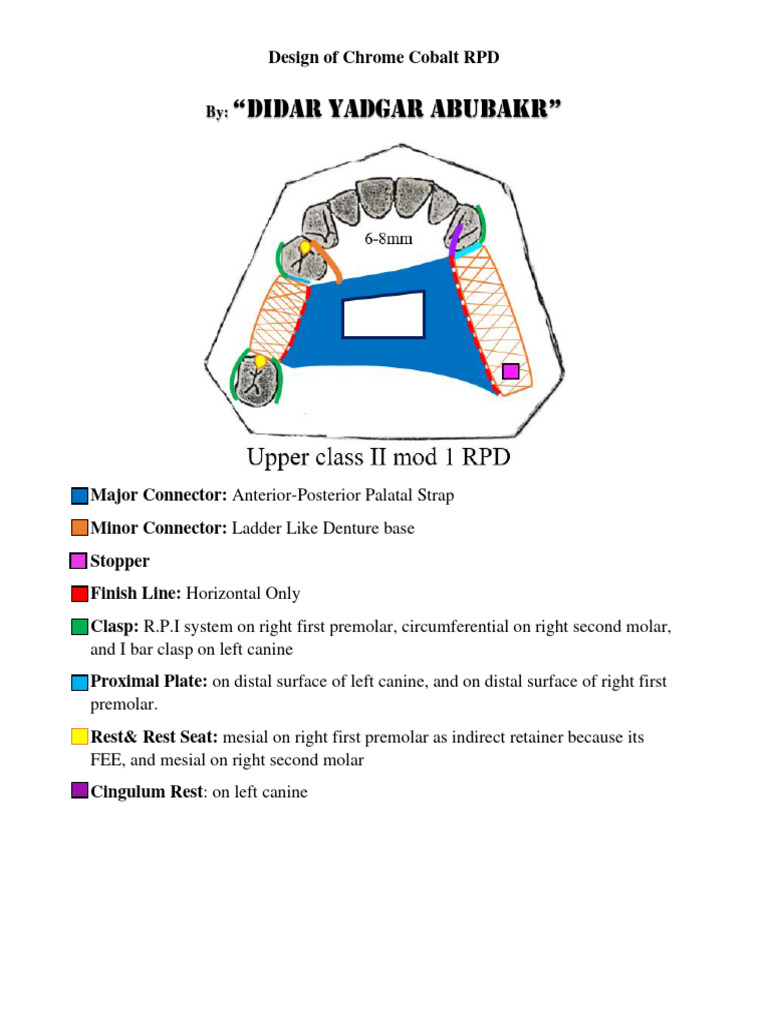 Chrome Cobalt RPD Design Overview | PDF | Dental Anatomy | Dentistry