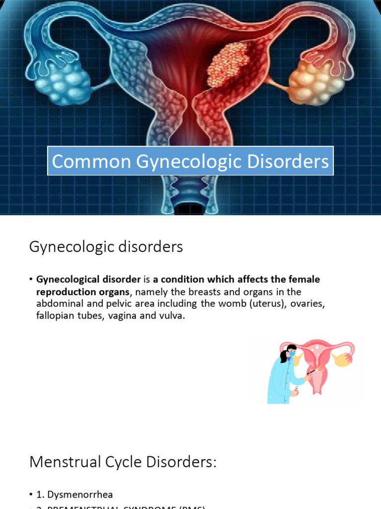 Gynecologic Problems | PDF | Vagina | Premenstrual Syndrome