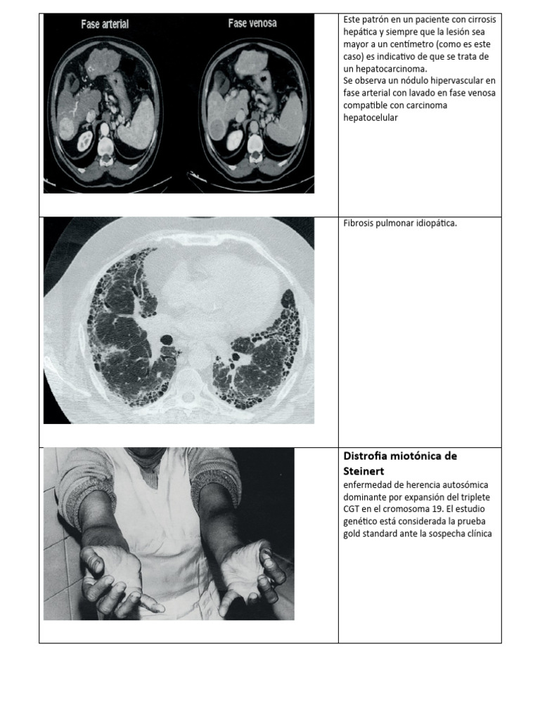 Imagenes Mir | PDF | Medicina | Enfermedades y trastornos