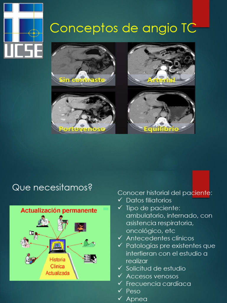 Guía Completa sobre Angio TC y Manejo de Contraste | PDF | Inyección ...