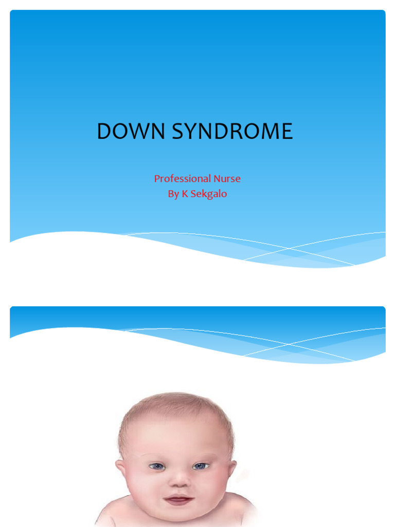 DOWN SYNDROME POWERPOINT | PDF | Down Syndrome | Respiratory Tract