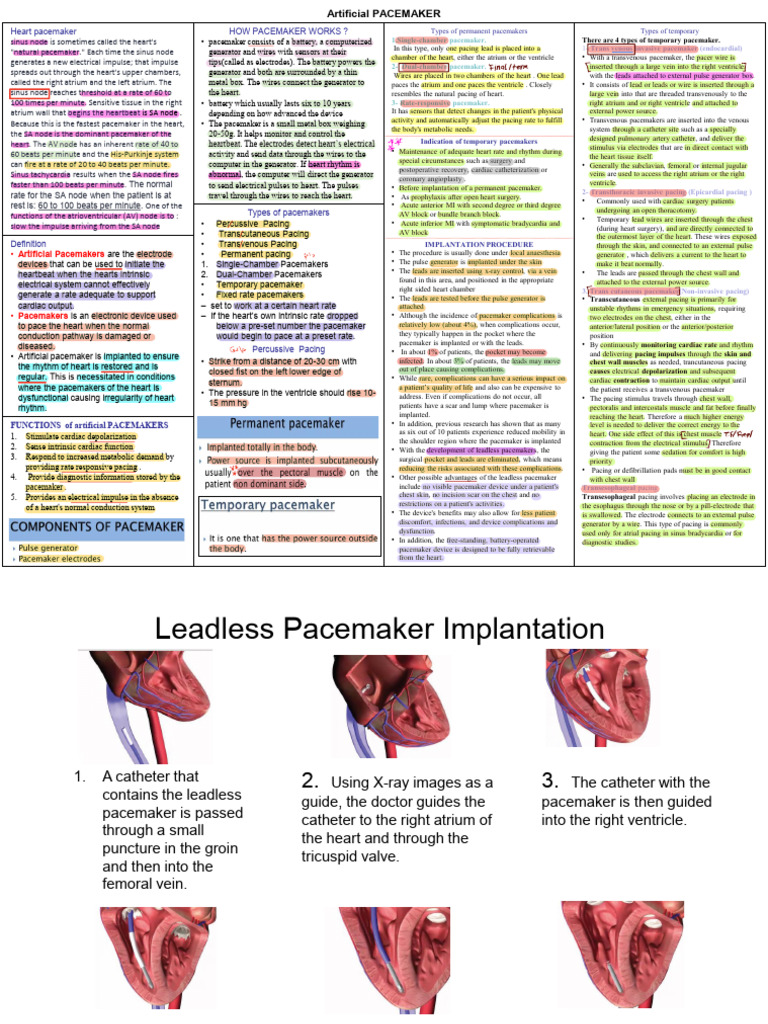 pacemaker(1)_2(1) | PDF | Artificial Cardiac Pacemaker | Heart