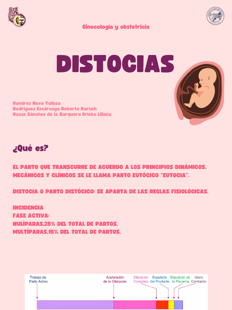 Distocias y Parto Pelvico | PDF | Parto | Pelvis