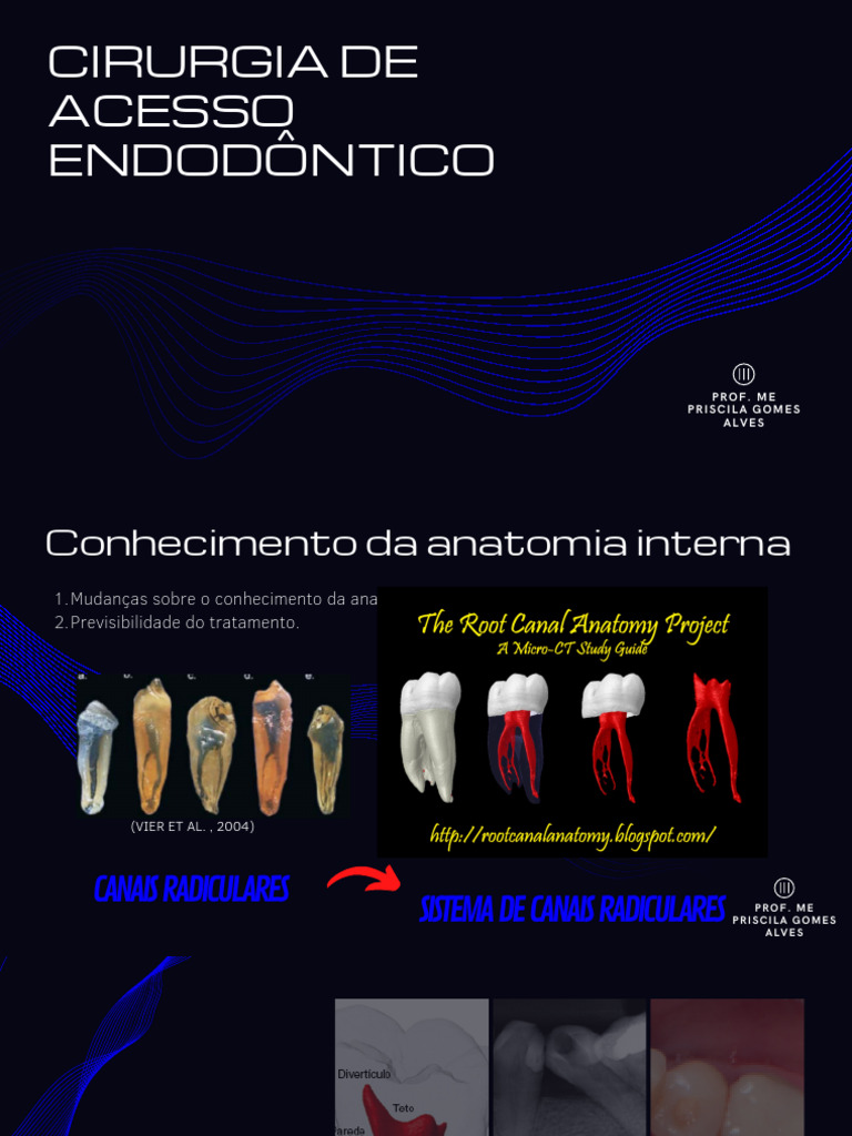 Cirurgia de Acesso Endodôntico | PDF | Anatomia dental | Áreas da ...