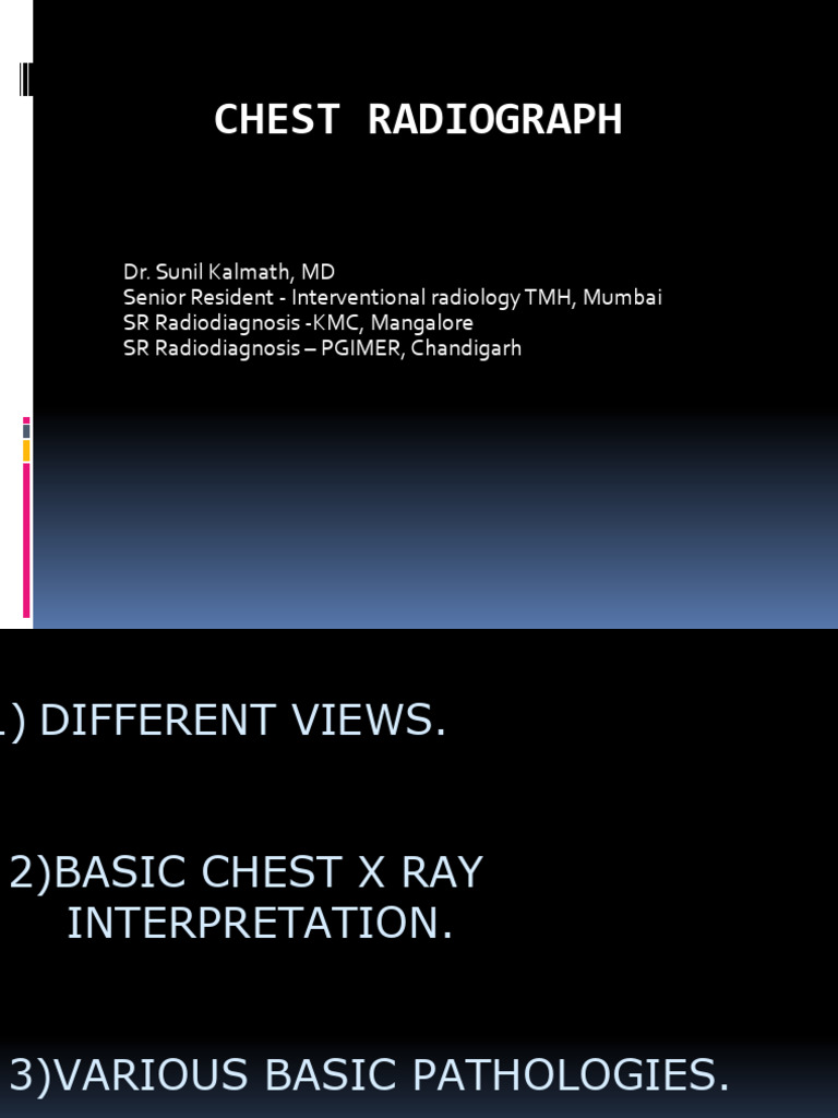 CHEST X-Ray | PDF | Anthropometry | Theory Of Medicine