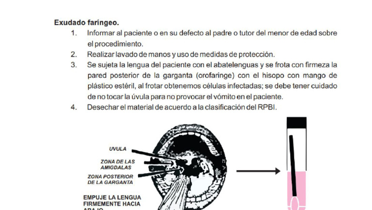 Exudado Faríngeo | PDF