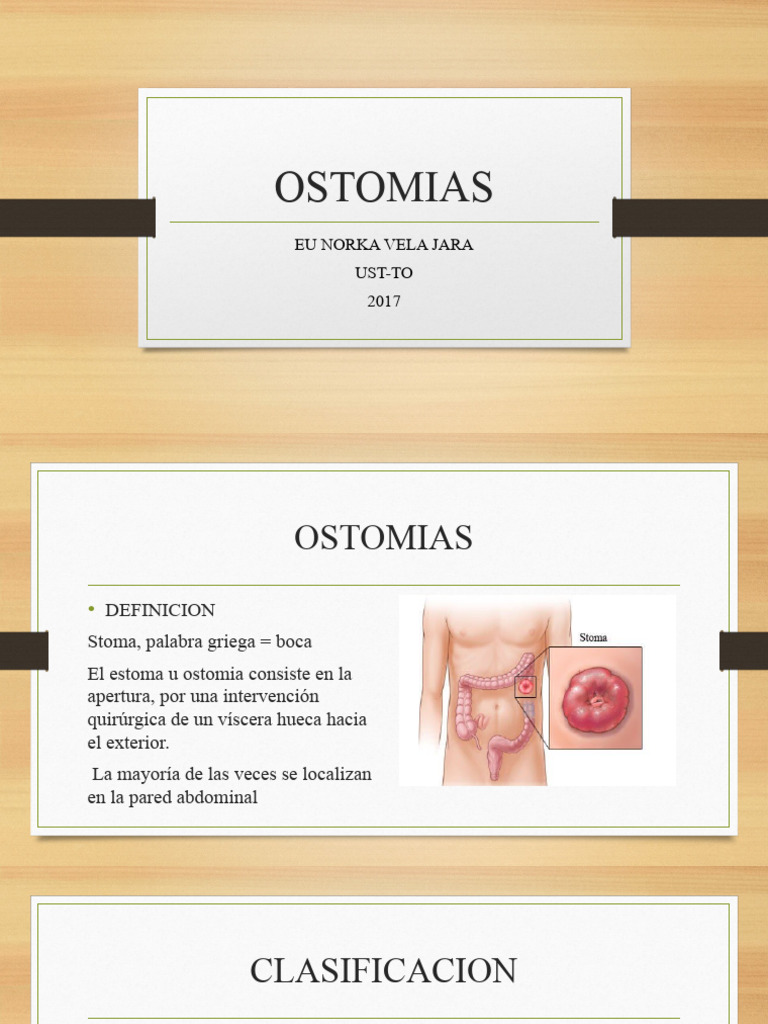 Clasificación y tipos de ostomías | PDF | Causas de la muerte ...