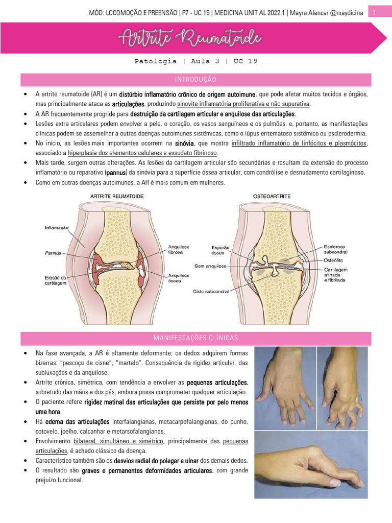 Patologia 3 - UC19 - Artrite Reumatoide | PDF | Inflamação | Artrite