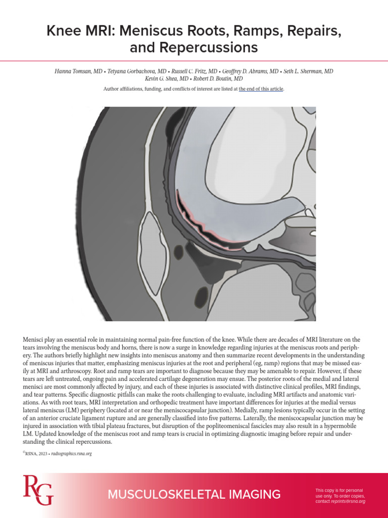 Tomsan Et Al 2023 Knee Mri Meniscus Roots Ramps Repairs and ...