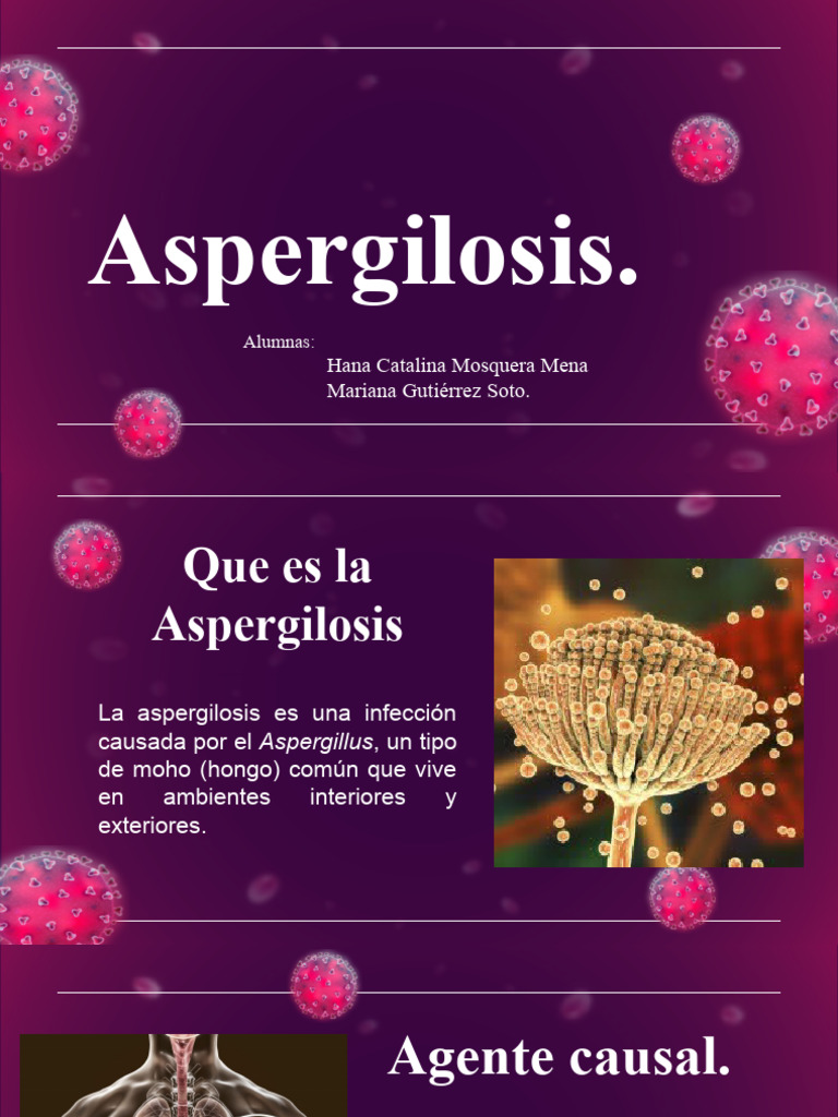 Exposición Aspergilosis | PDF | Asma | Medicina CLINICA
