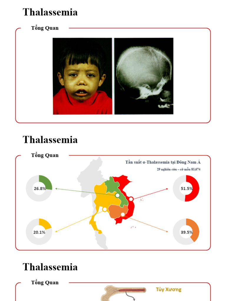Thalassemia | PDF