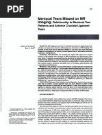 MRI Meniscus Tear Grading Guide | PDF