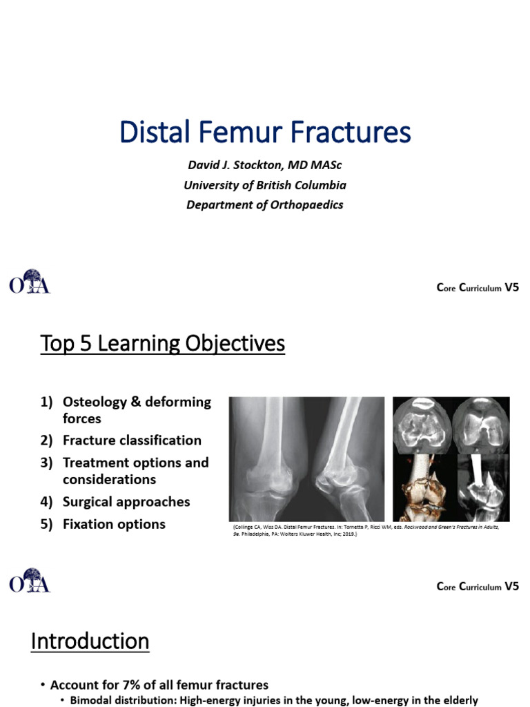 Distal Femur Fractures | PDF | Knee | Injury
