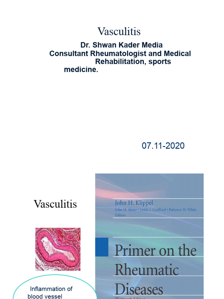 Vasculitis | PDF | Causes Of Death | Epidemiology