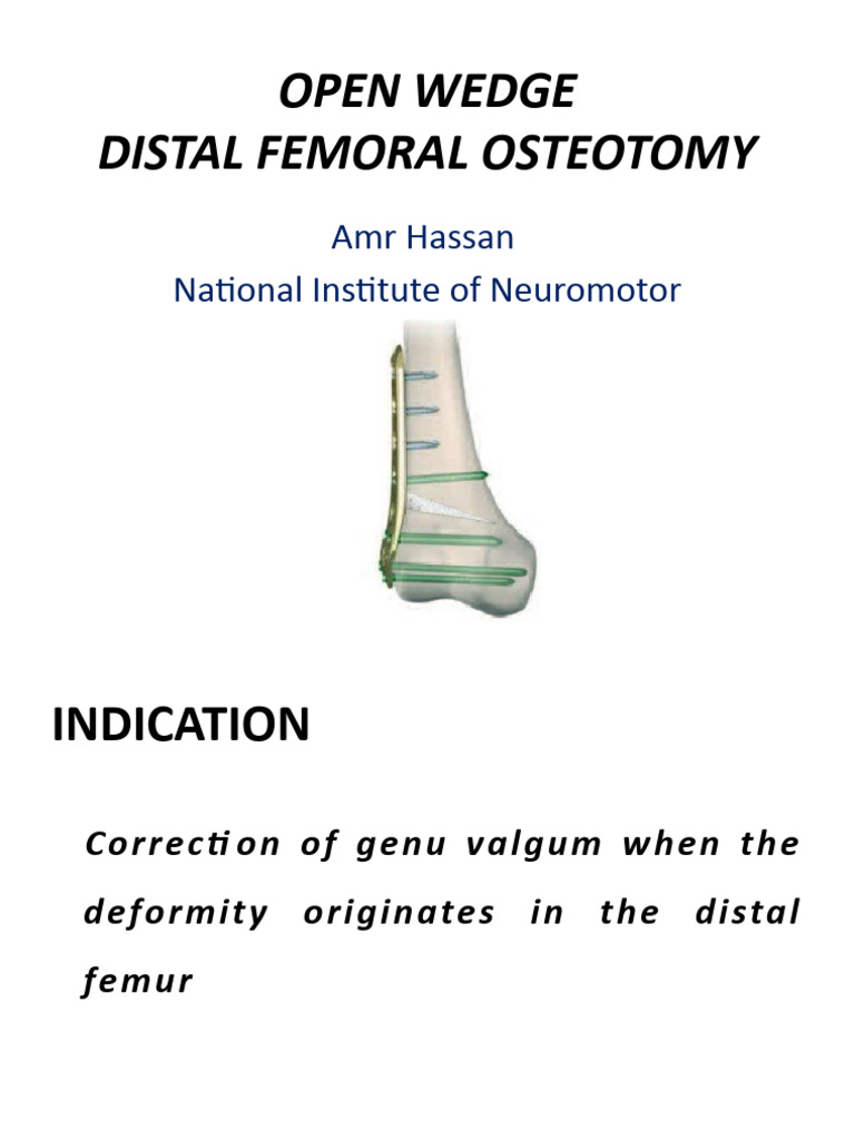 OPEN WEDGE Distal Femoral Osteotomy | PDF | Knee | Musculoskeletal System