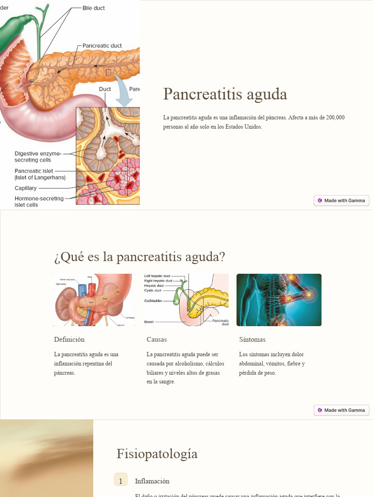Pancreatitis Aguda Presentacion | Descargar gratis PDF | Enfermedades y trastornos humanos ...