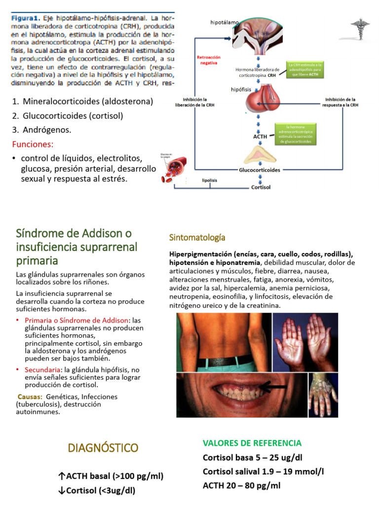 Síndrome de Addison: Diagnóstico y Síntomas | PDF