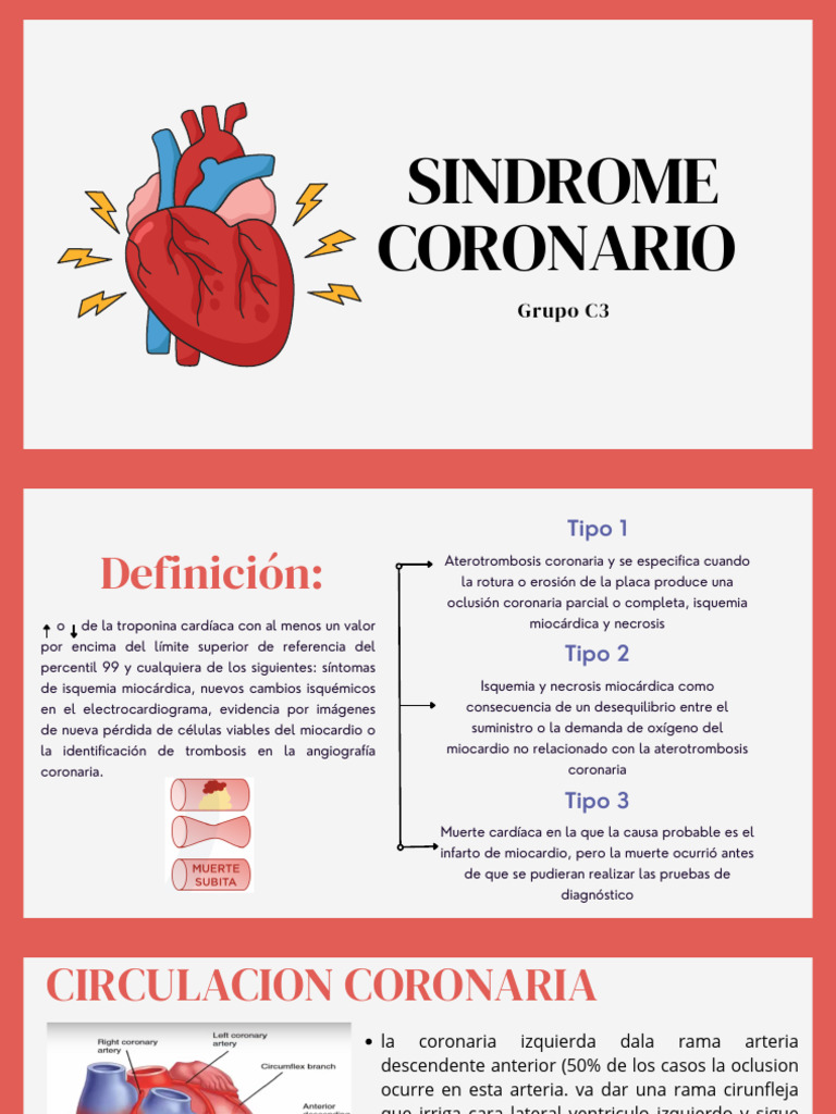 Angina Inestable Infarto Con y Sin Elevación Del ST | PDF | Infarto de ...