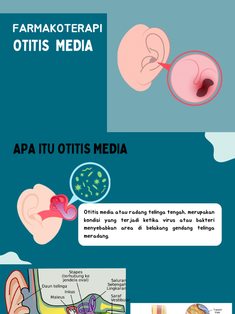 Panduan Terapi Otitis Media Akut | PDF