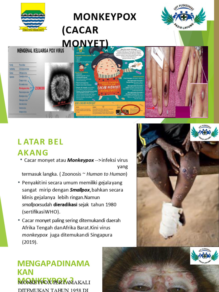 Diagnosis Dan Penanganan Monkeypox Virus | PDF