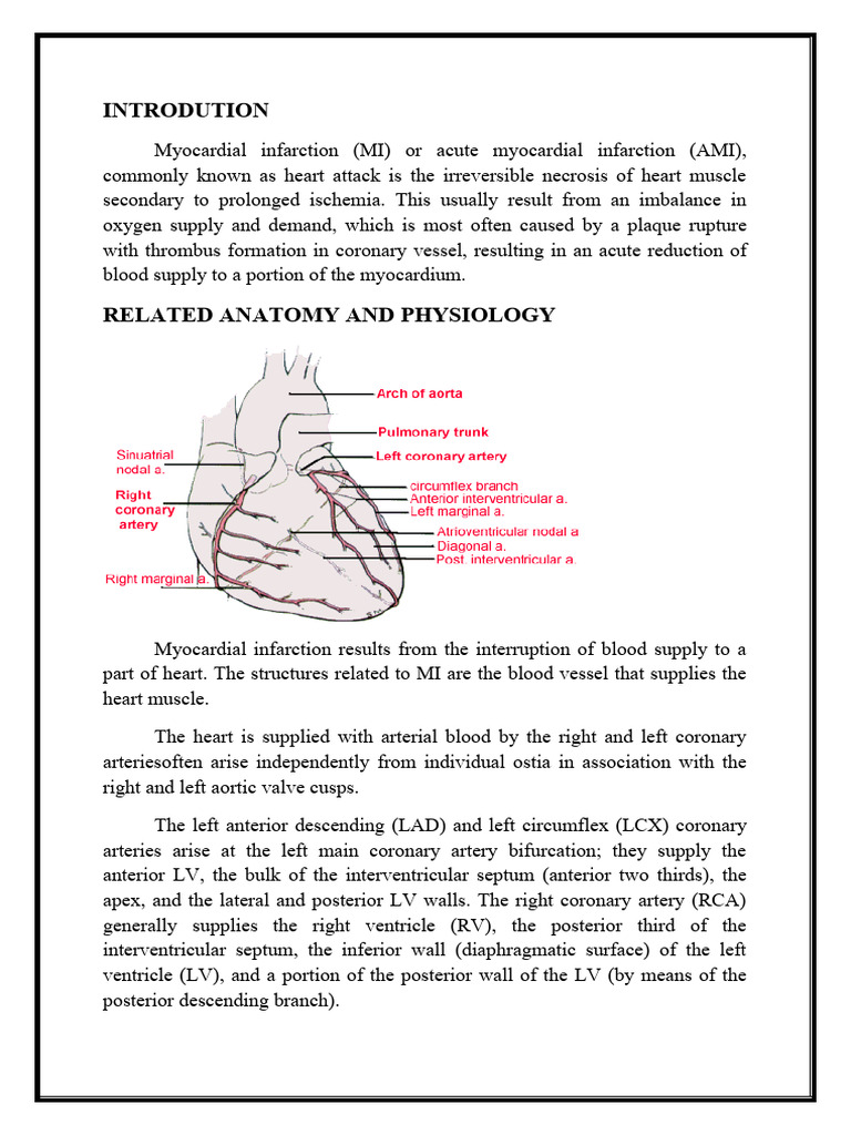 Myocardial Infarction | PDF | Myocardial Infarction | Coronary Circulation