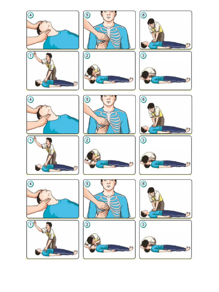 Gambar CPR | PDF