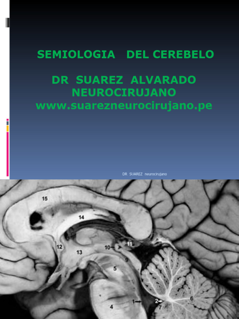 Clase 8 Semio Cerebelo 2020 | PDF | Cerebelo | Neurociencia