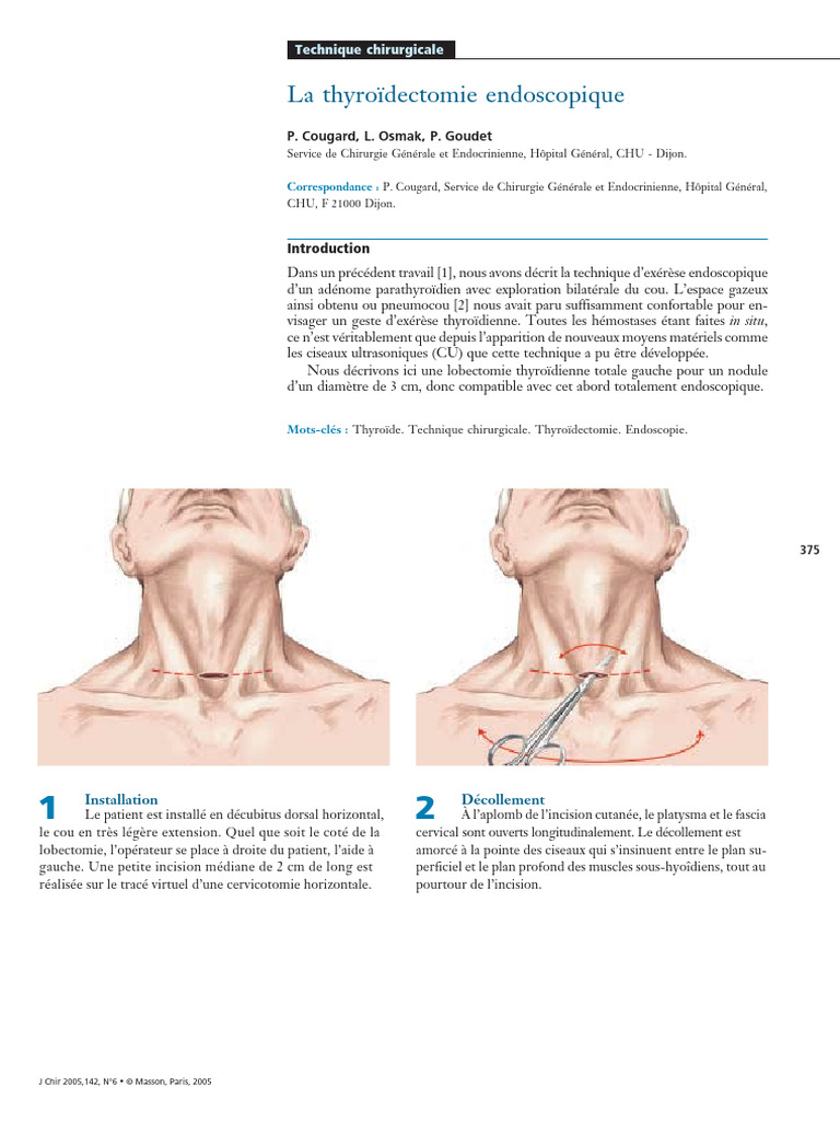 Thyroïdectomie endoscopique totale | PDF | Thyroïde | Glandes