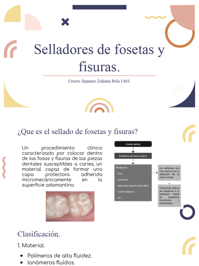Selladores de Fosetas y Fisuras Dentales | PDF | Diente | Esmalte de ...