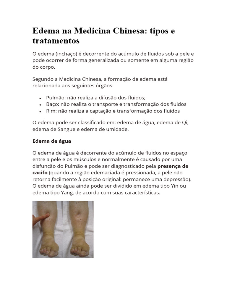Tipos de Edema na Medicina Chinesa | PDF | Edema | Medicina Clínica