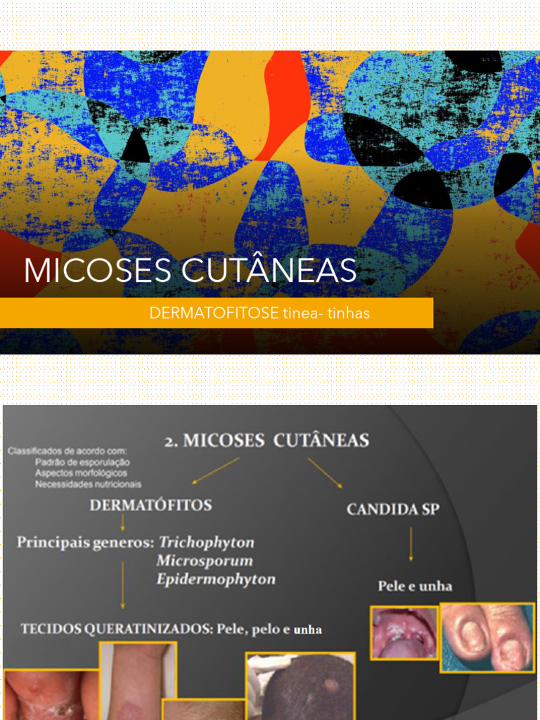 Dermatofitose: Tipos e Tratamentos | PDF | Sistema imunológico | Fungo