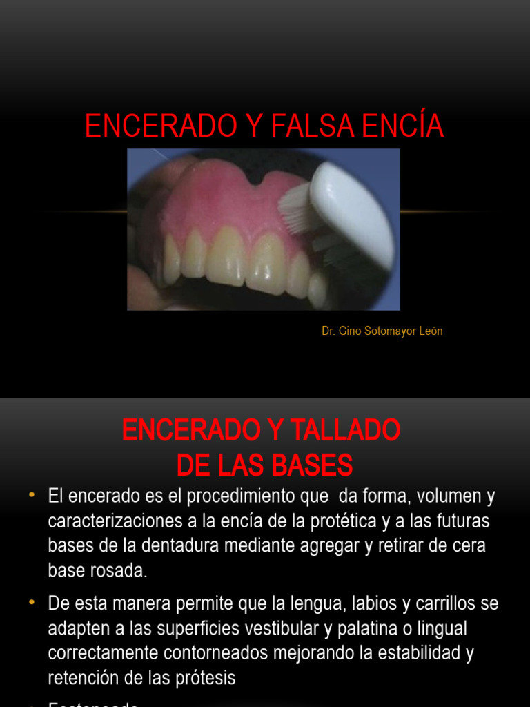 Encerado y Tallado de Las Bases | PDF | Ramas de Odontología | Anatomia dental