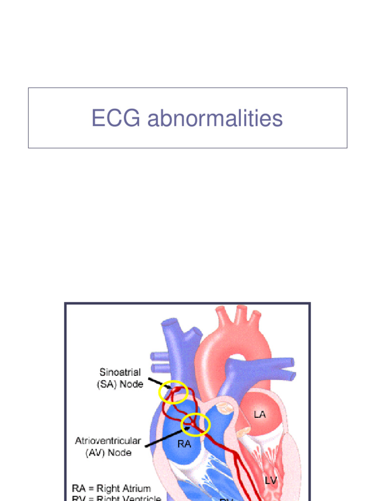 Cardiology - ECG WORKSHOP | PDF | Electrocardiography | Atrium (Heart)