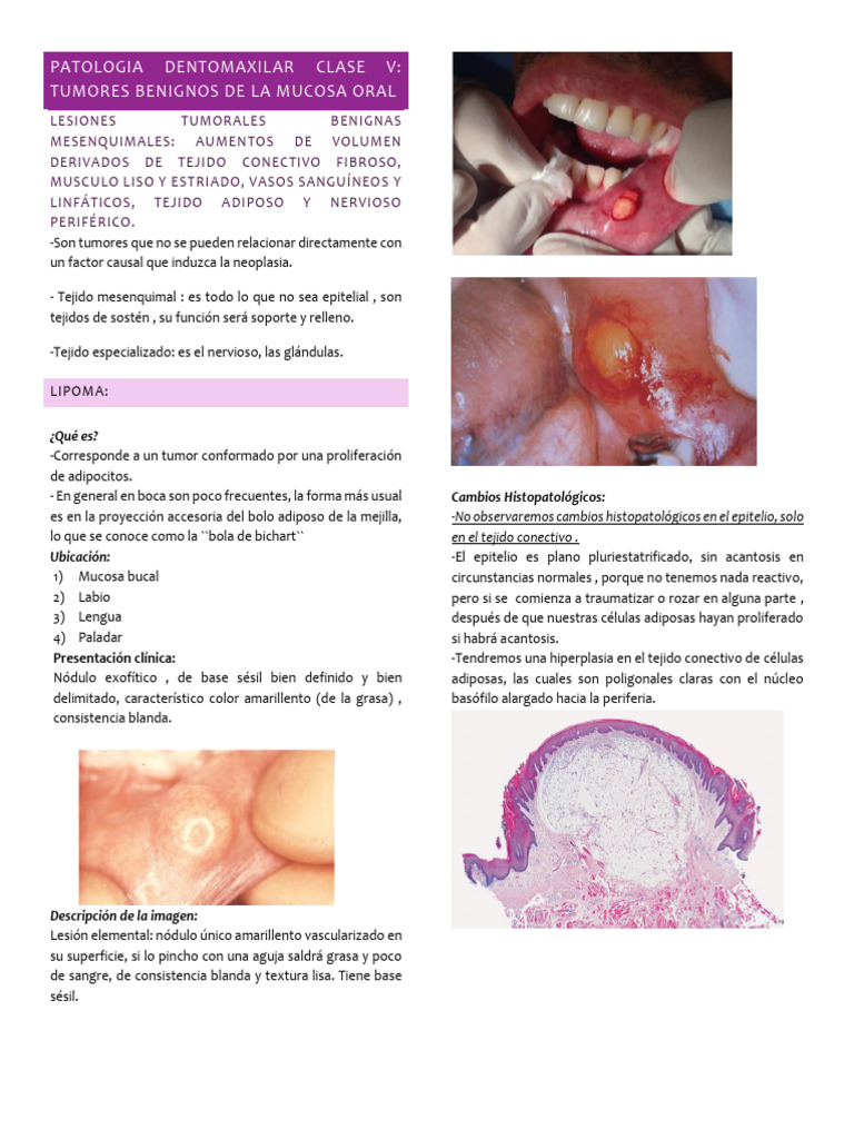 Tumores Benignos Mesenquimales | PDF | Neoplasias | Tejido conectivo