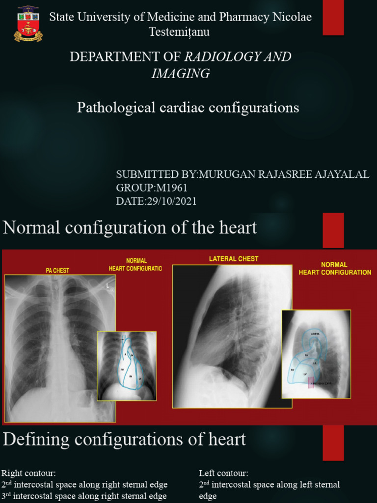 Pathologic Cardiac Configuraion Ajay | PDF | Heart | Ventricle (Heart)