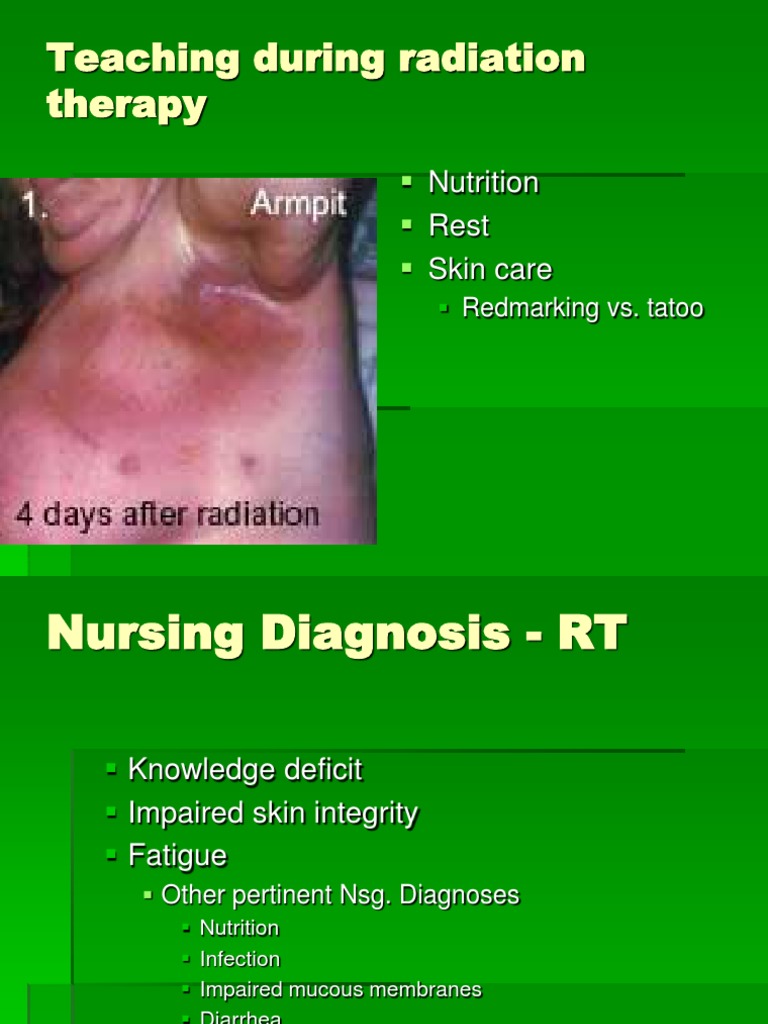Teaching During Radiation Therapy: Nutrition Rest Skin Care | PDF ...