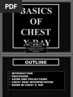 AP vs PA Chest X-Ray Differences | PDF | Radiography | Radiology