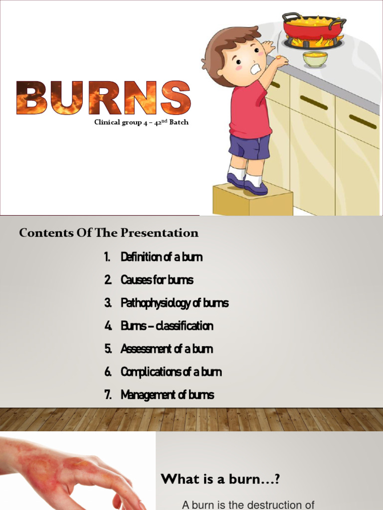 Management of Burns - CG 4 - 42ND BATCH | PDF | Burn | Diseases And ...