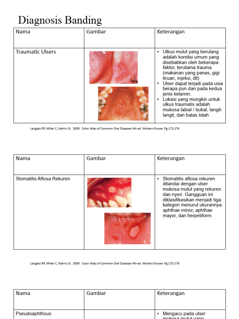 Diagnosis Banding & Tatalaksana Traumatic Ulser | PDF